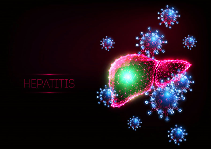 Penyebab Penyakit Hati Hepatitis Akut - Autoimuncare Indonesia